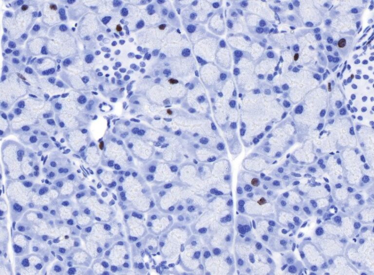 Ribosomes and Translation in Pancreatic Acinar Cells – Cho Lab