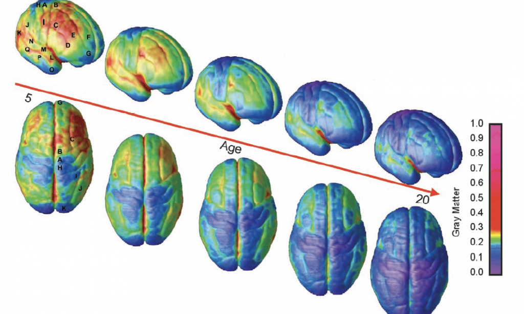 Music Nostalgia and the Adolescent Brain – The Adolescent Brain